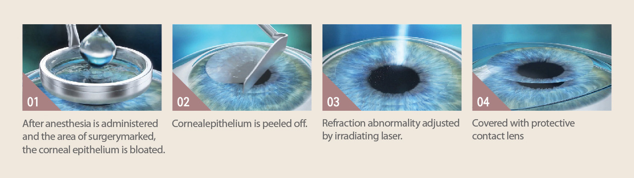 Presbyopia and cataract surgery